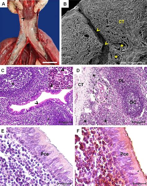 Gut Associated Lymphoid Tissue Histology