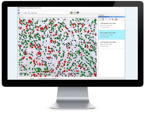 Clinical Image Analysis All Imaging Tools In One System