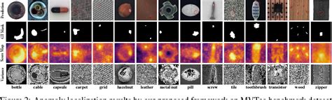 Figure 2 From Sanflow Semantic Aware Normalizing Flow For Anomaly