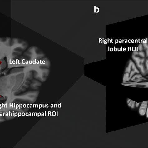 Resting State Connectivity Temporal Functional Connectivity Was