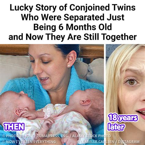 Abbigail And Isabelle Carlsen Now Ive Seen Everything