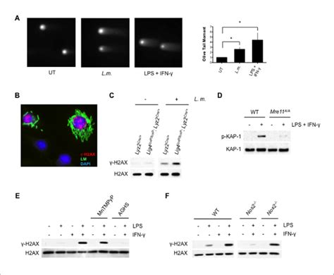 Activation Of DDR By DNA DSBs A Neutral Comet Assay And Olive Tail Download Scientific