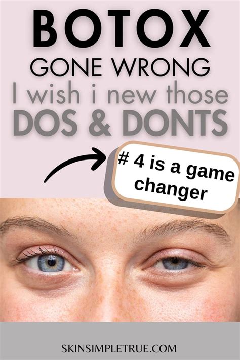 Worst Botox Complication Droopy Eyelid Learn The Botox Dos And Donts