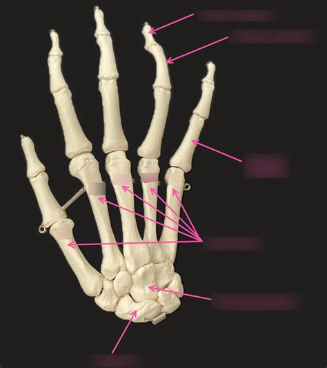 Metacarpals Phalanges Carapals 1 Diagram Quizlet