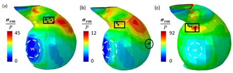 Distribution Of Computed Von Mises Stress Over Pressure In A The Download Scientific Diagram