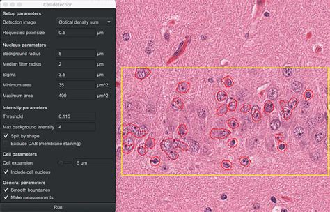 difficulty with he cell detection on qupath usage and issues image sc