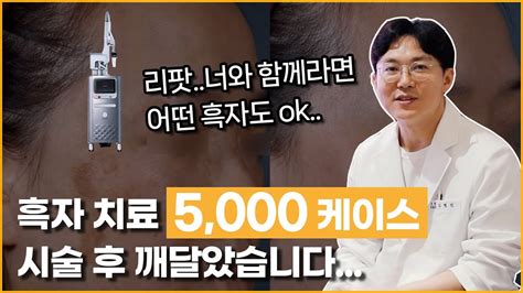 충격고백흑자검버섯 치료 5000케이스 이상 시술 후 깨달았습니다 Youtube