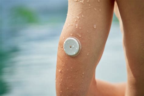 Continuous Glucose Monitoring Wild Rice Wellness