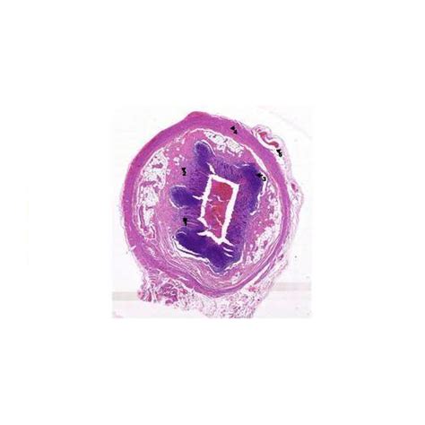Appendix Histology Appendix Histology