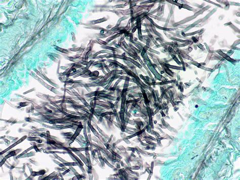 Gms Stain Aspergillus Histology Slides