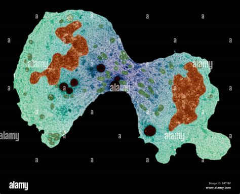 Cancer Cell Division Coloured Transmissionelectron Micrograph Tem Of A Section Through A