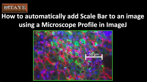 Automatically Add Scale Bar To An Image Using A Microscope Profile In Imagej Youtube