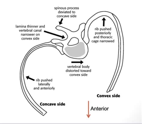 Thoracic Spine Flashcards Quizlet