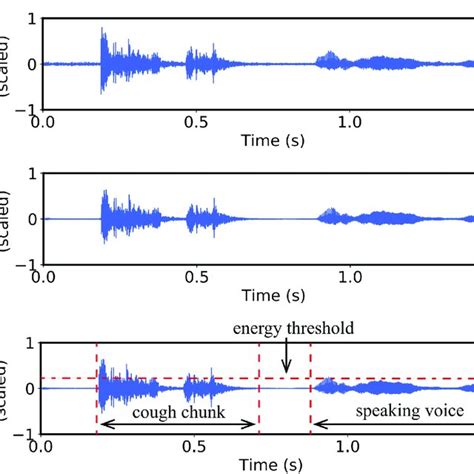 example of preprocessing and patient audio segmentation waveforms a
