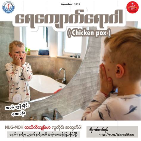 ရေကျောက်ရောဂါ Chicken Pox တယ်လီကျန်းမာ