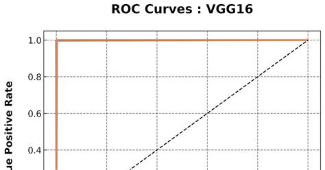Brain And Deep Learning Deep Learning For Cerebral Hemorrhage Detection And Classification In
