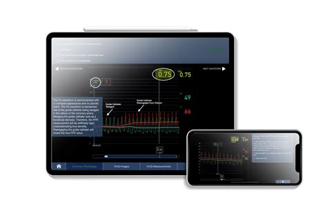 Medical Device Industry Experience Syncro Medical