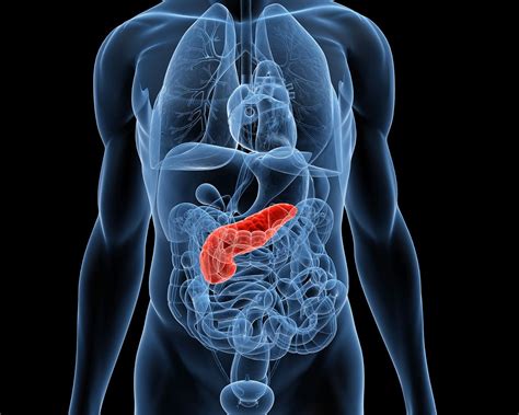 Immune Cell Gives Possible Explanation For Sex Differences In Pancreatic Cancer Bioquick News