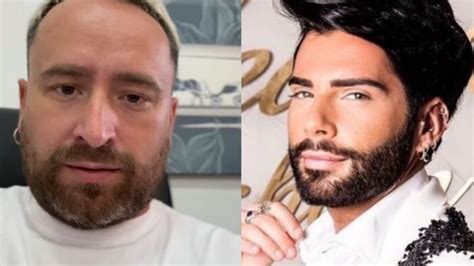 Trattamenti Extra E Conti Alle Stelle Mosca Interviene Sul Caso Federico Fashion Style