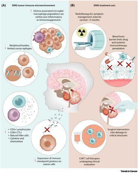 Car T Cell Therapies For Diffuse Midline Glioma Trends In Cancer