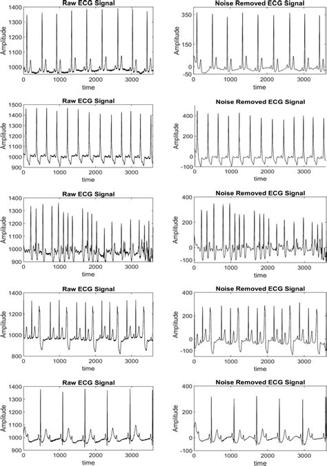 Raw Ecg Signals And Noise Removed Ecg Signals Download Scientific