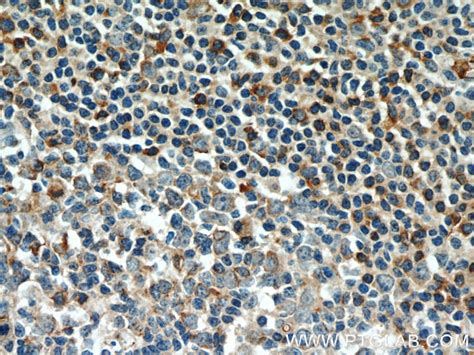 Integrin Beta 1 Antibody 12594 1 Ap Proteintech
