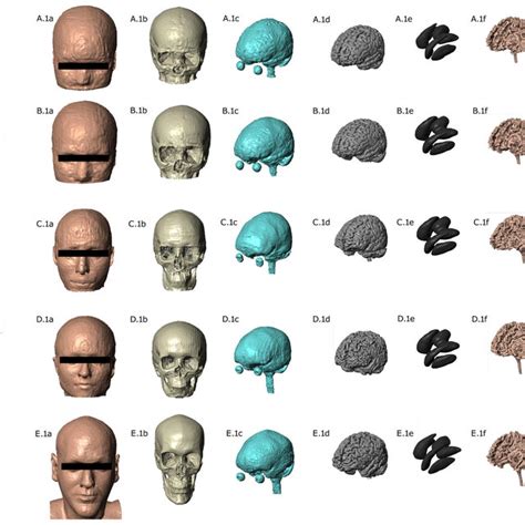 Skin And Skull Thickness Are Among Important Factors That Determine The Download Scientific