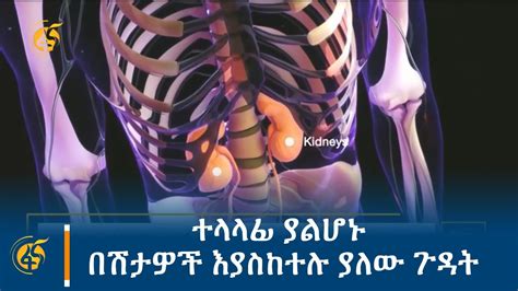 ተላላፊ ያልሆኑ በሽታዎች እያስከተሉ ያለው ጉዳት Youtube