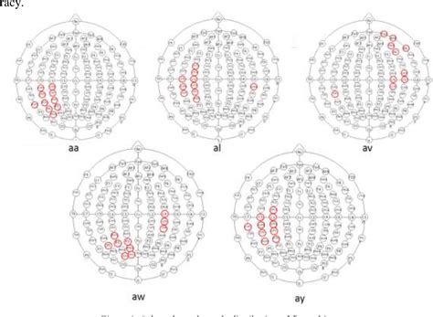 Figure From Channel Selection With Eeg Source Imaging Semantic Scholar