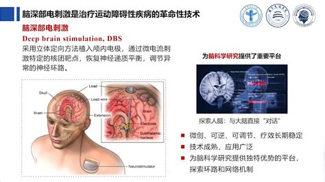 张建国教授：运动障碍性疾病的环路机制研究及调控干预 脑医汇