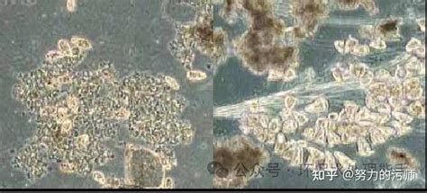 活性污泥法的起源、什么是活性污泥 知乎