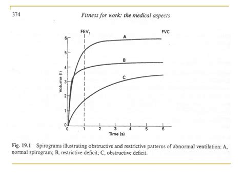 Interpretation Normal Spirometry Obstructive Pattern Ppt Download