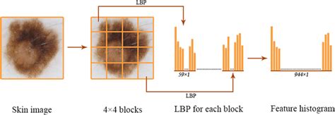 Illustration Of Lbp Representation Download Scientific Diagram