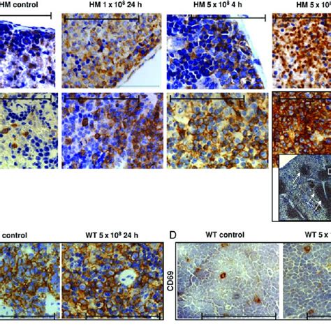 Staphylococcus Aureus Infection Increased Apoptosis In Humanized Mice