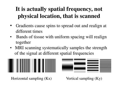 Ppt Basic Physical Principles Of Mri Powerpoint Presentation Free