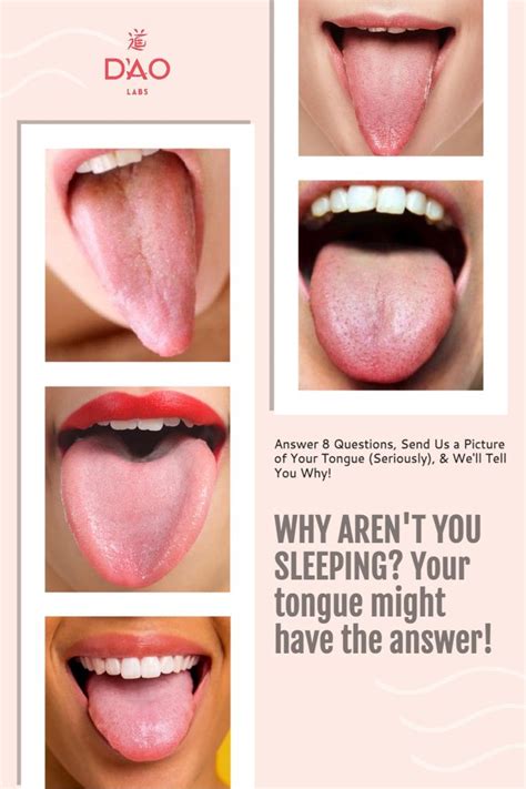 Learn What Your Tongue Says About Your Health Tongue Health Chinese Herbal Medicine Muscles