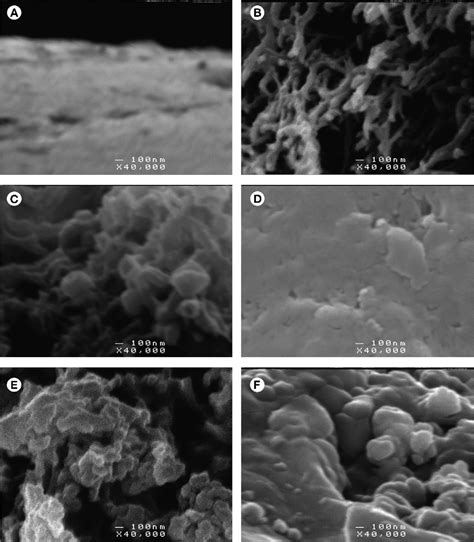 SEM Photographs Nm Length Scale And Magnification Of The Download Scientific