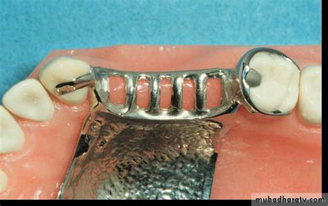 Minor Connector Pptx د عمر زينو التحو Muhadharaty