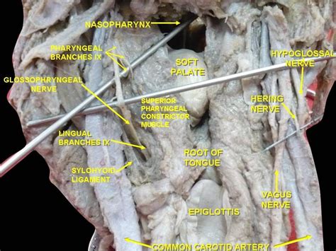 Glossopharyngeal Nerve Block Iowa Head And Neck Protocols Carver College Of Medicine The