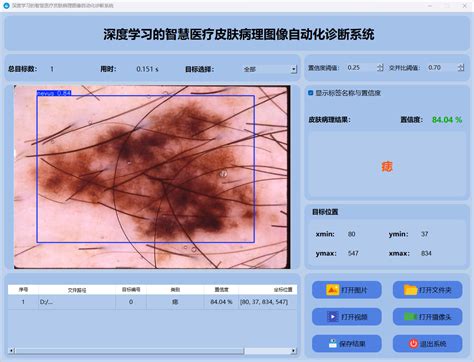 基于yolov8深度学习的智慧医疗皮肤病理图像自动化诊断系统pyqt5界面数据集训练代码 中猿创新 7zcode