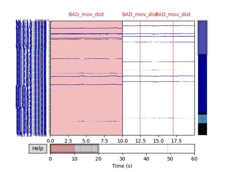 Annotate Movement Artifacts And Reestimate Dev Head T — Mne 0 22 1 Documentation