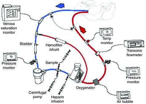 Ecmo Circuit