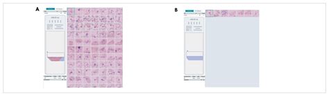 Hemabook Chapter 25 Leading The Way In Platelet Counting Innovation Hemabook Chapter 25 Leading The Way In Platelet Counting Innovation