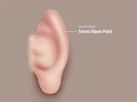 tennis elbow point master tung s acupuncture elotus core