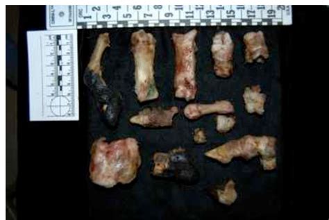 Figure 99 Soft Tissues Of The Right Carpals Metacarpals