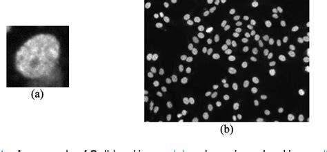 figure 1 from hep 2 specimen image segmentation and classification