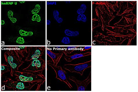 Hnrnp U Antibody Pa5 63604