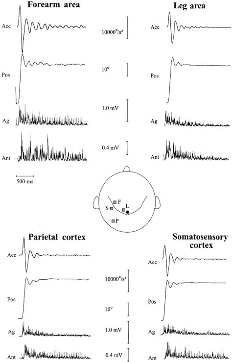 Effects Of Different Stimulus Positions On Rapid Wrist Extension Download Scientific Diagram