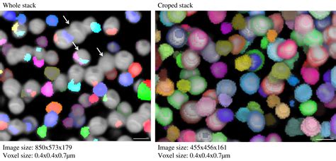 Erronous Segmentation Of The Whole Stack But A Cropped Region Works Perfectly Issue