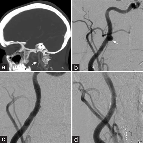 Surgical Neurology International